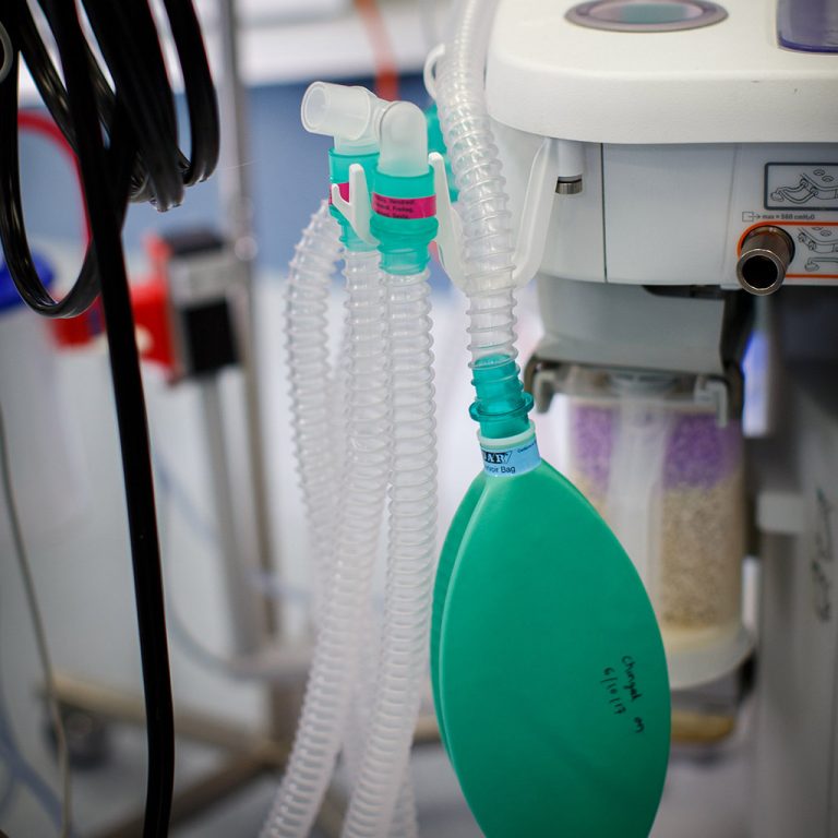 Ureteric Stents - Northern Urology Specialists Sydney - Dr Kris Rasiah